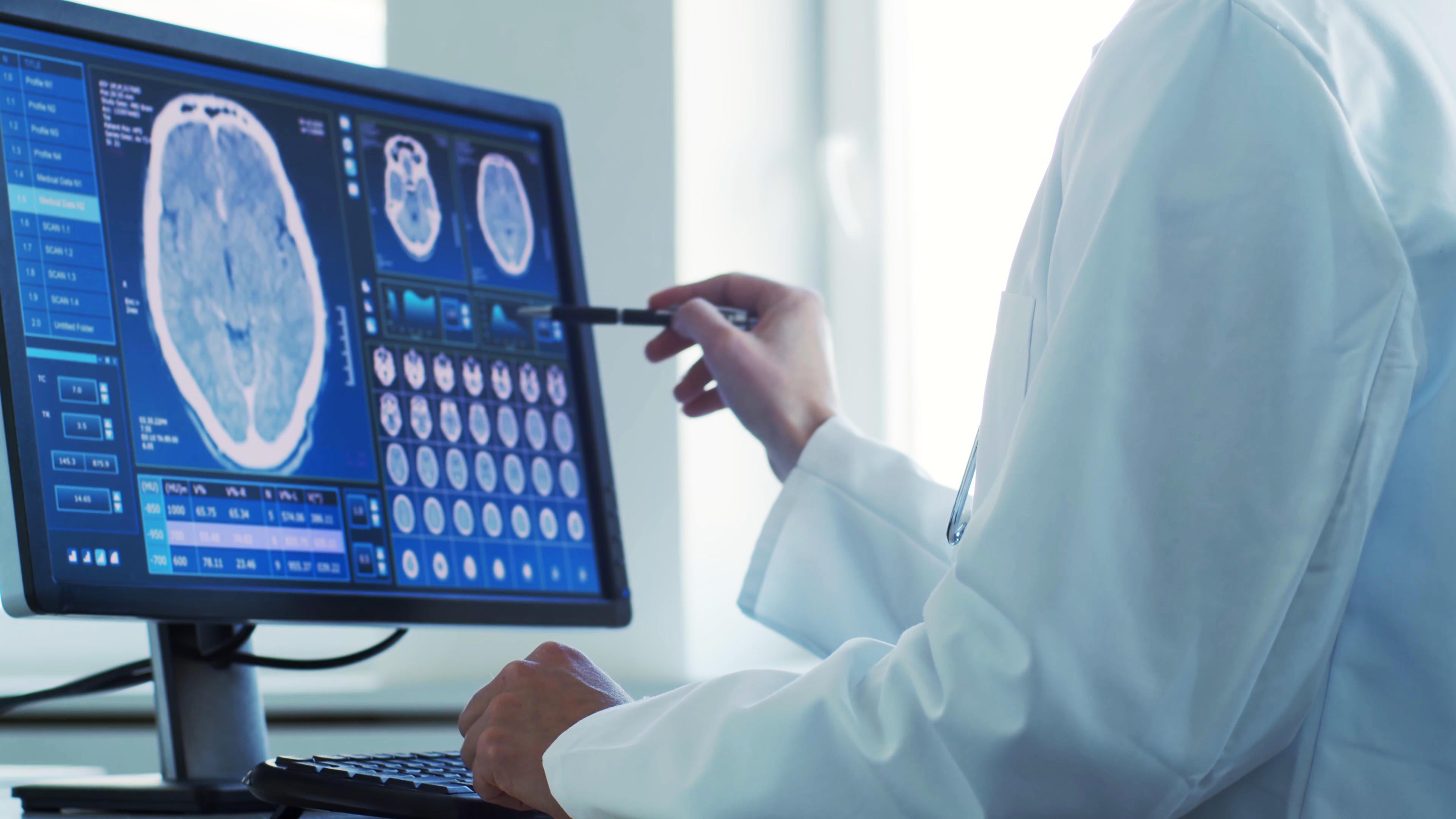 1st SSMC International Stroke Symposium – Sheikh Shakhbout Medical City ...